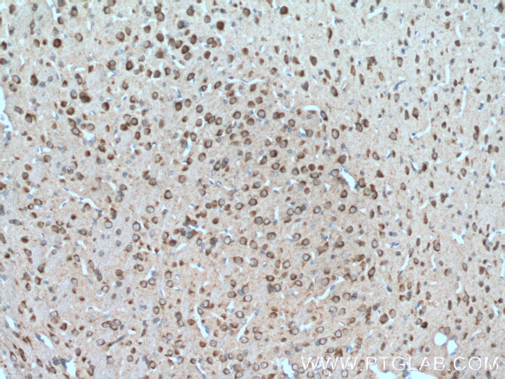 PARK2/Parkin Antibody 14060-1-AP | Proteintech