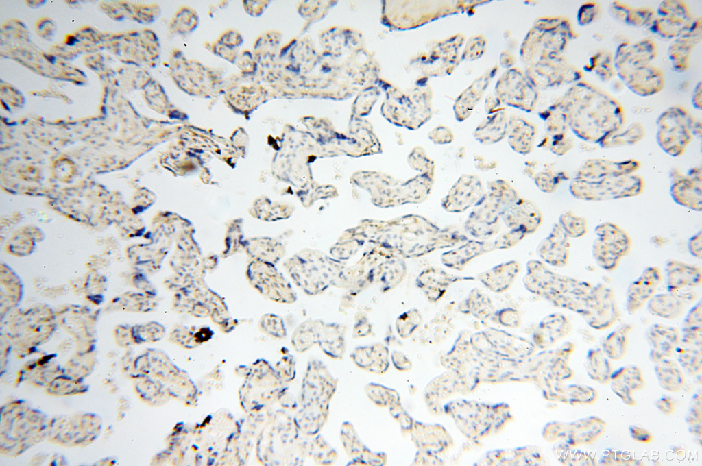 Granulin Antibody 10053-1-AP | Proteintech