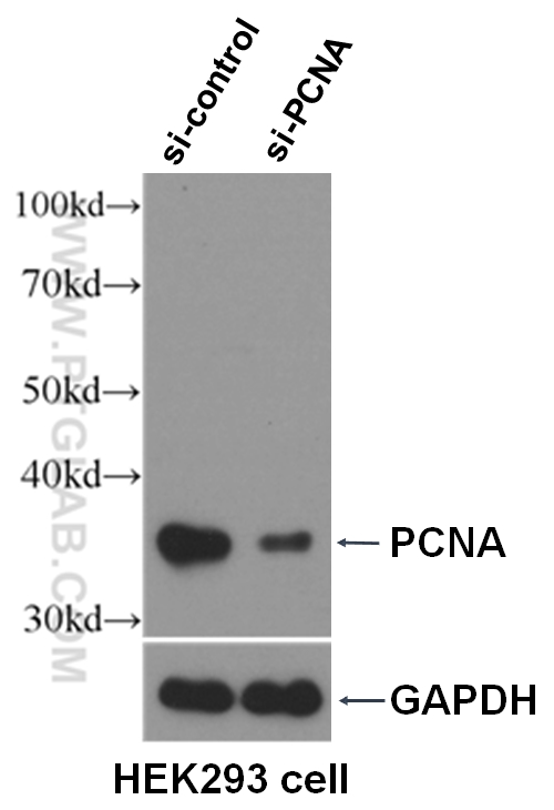 PCNA Antibody 10205-2-AP | Proteintech