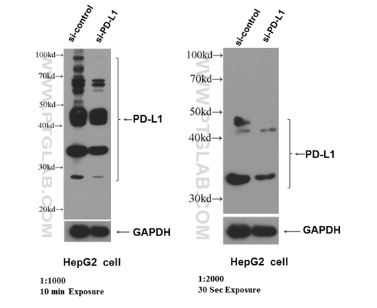 PD-L1/CD274 Antibody 66248-1-Ig | Proteintech