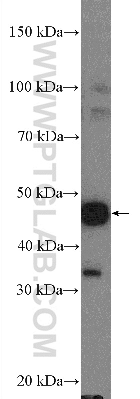 PD-1/CD279 Antibody 18106-1-AP | Proteintech