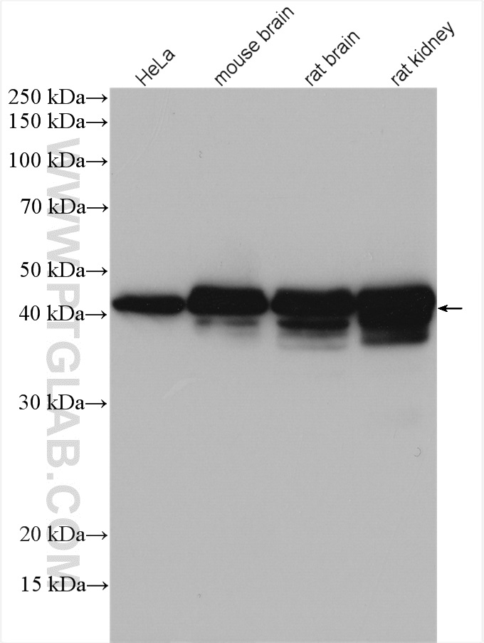 PDH E1 Alpha Antibody 18068-1-AP | Proteintech