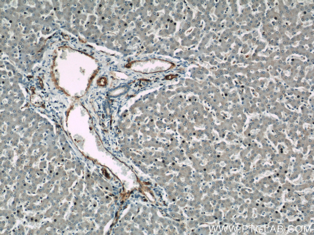 CD31 Antibody 11265-1-AP | Proteintech