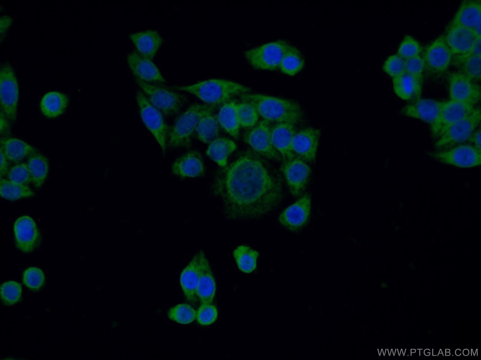 PERK/EIF2AK3 Antibody 20582-1-AP | Proteintech