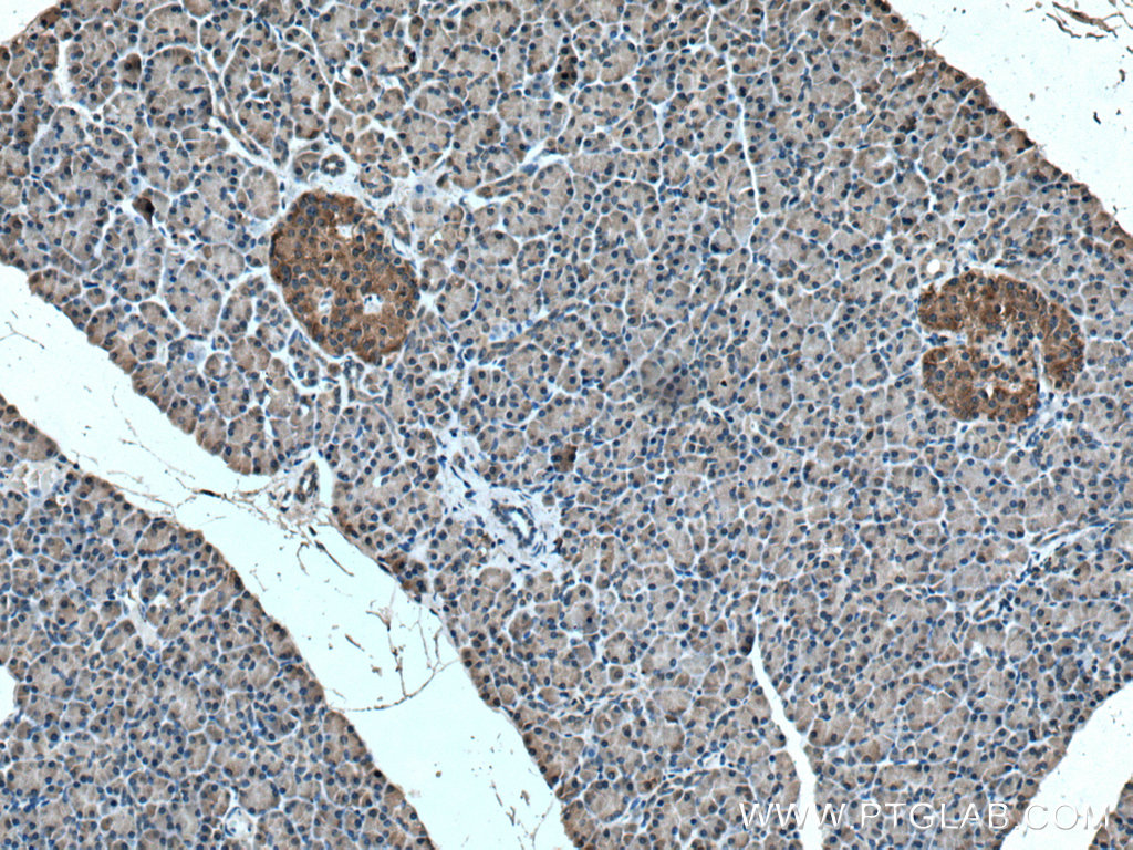 PERK/EIF2AK3 Antibody 20582-1-AP | Proteintech