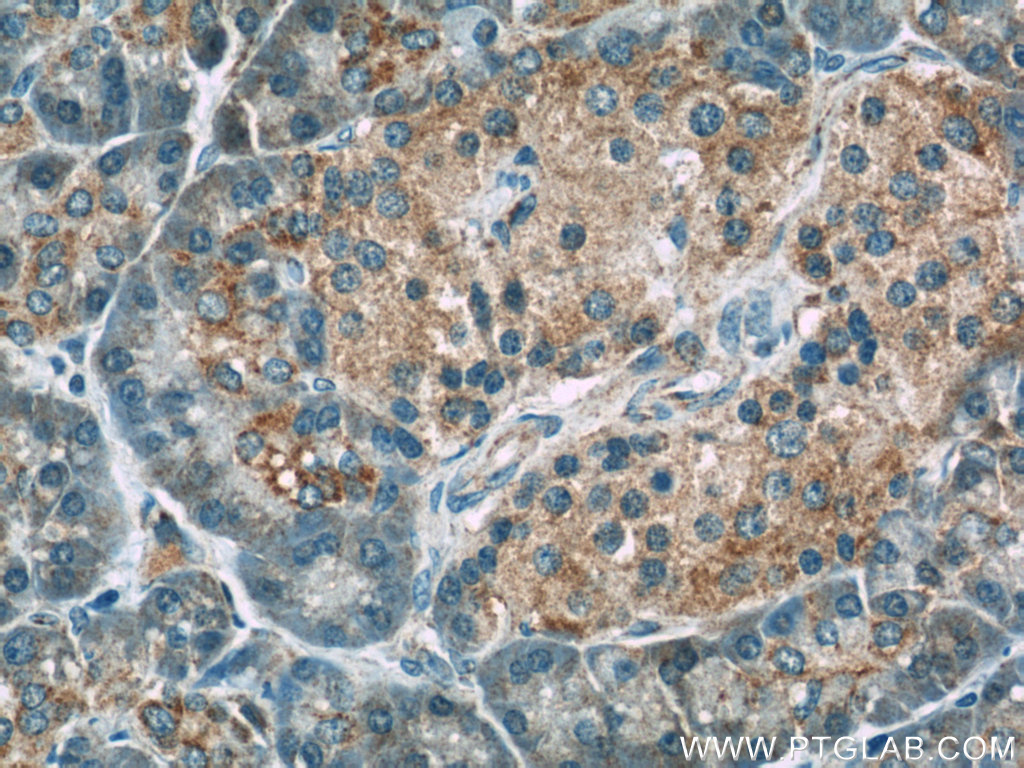 PERK/EIF2AK3 Antibody 20582-1-AP | Proteintech