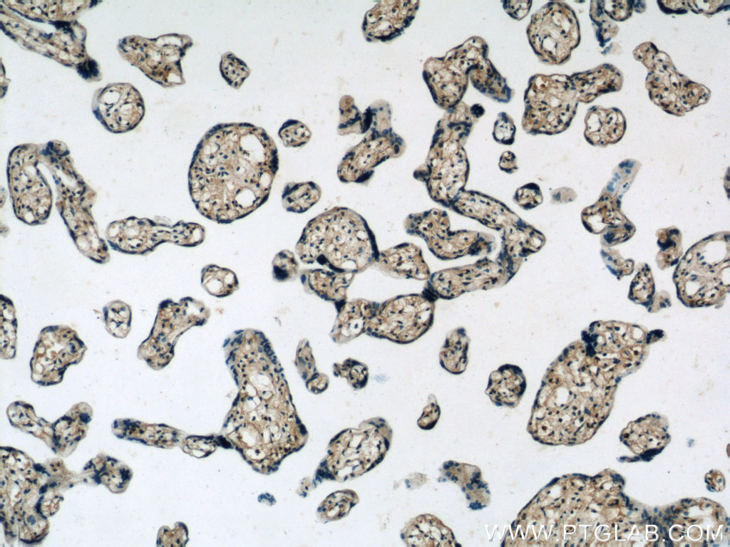 PERK/EIF2AK3 Antibody 20582-1-AP | Proteintech