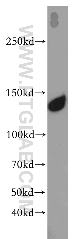 PERK/EIF2AK3 Antibody 20582-1-AP | Proteintech