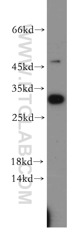 PGAM1 Antibody 16126-1-AP | Proteintech