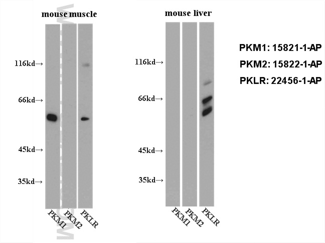 PKM2-specific Antibody 15822-1-AP | Proteintech