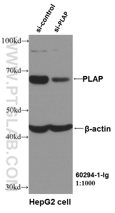 PLAP Antibody 60294-1-Ig | Proteintech