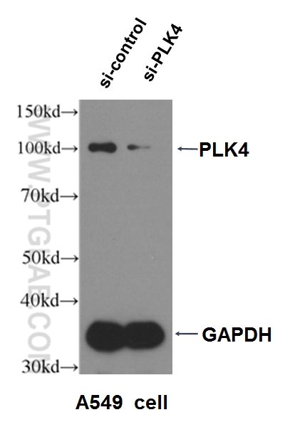 PLK4 Antibody 12952-1-AP | Proteintech