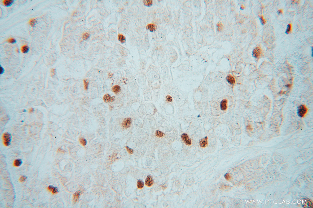 PRC1 Antibody 15617-1-AP | Proteintech