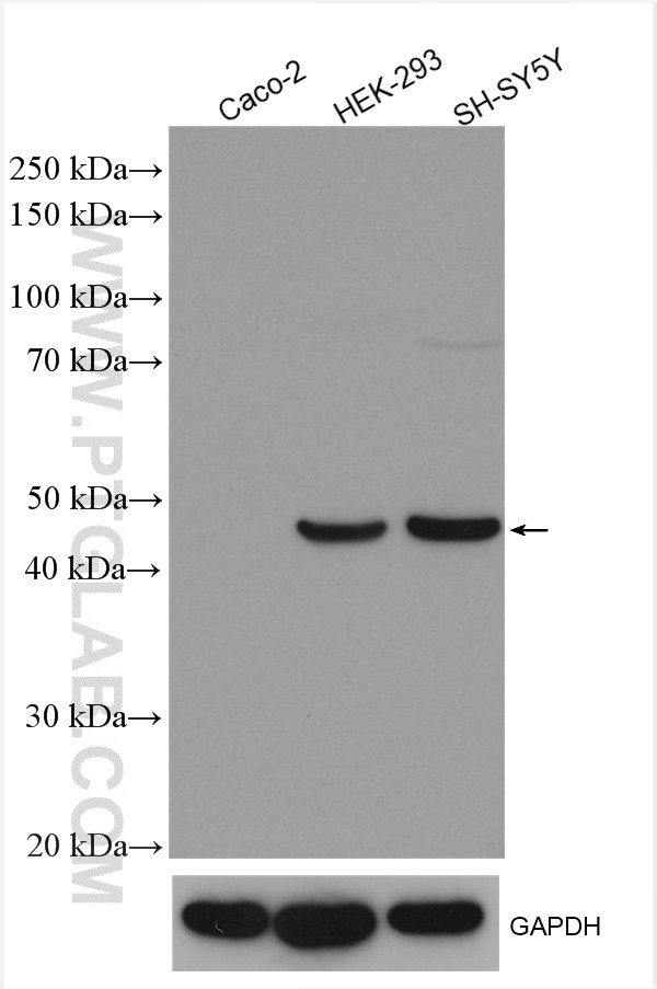 PRMT8 Antibody 12557-1-AP | Proteintech