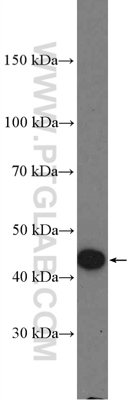PRMT8 Antibody 12557-1-AP | Proteintech