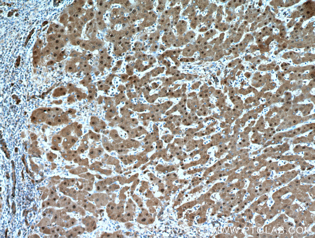 PSMB5 Antibody 19178-1-AP | Proteintech
