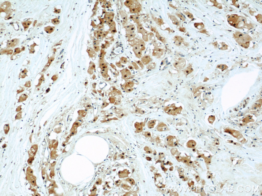 PSMB5 Antibody 19178-1-AP | Proteintech