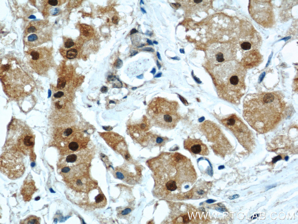 PSMB5 Antibody 19178-1-AP | Proteintech