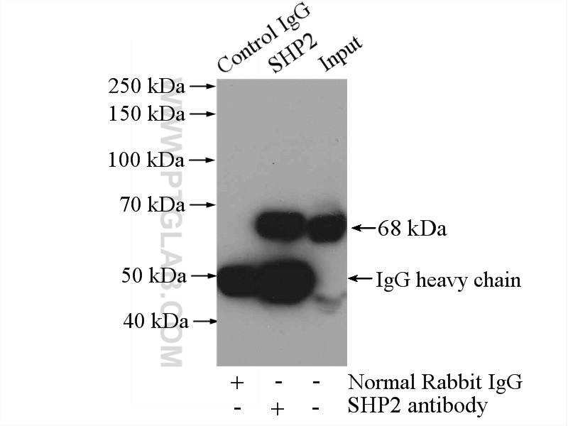 SHP2 Antibody 20145-1-AP | Proteintech