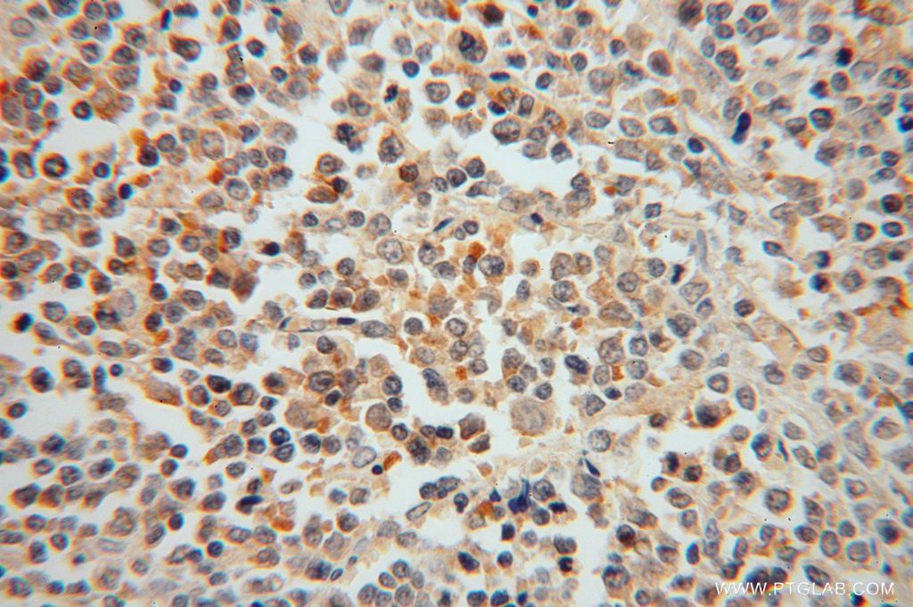 PTPN7 Antibody 15286-1-AP | Proteintech