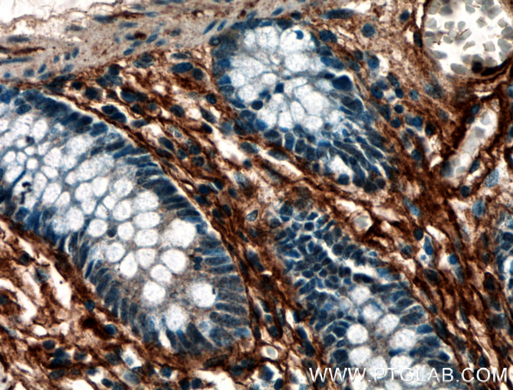 Periostin Antibody 27794-1-AP | Proteintech