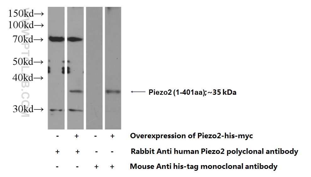 Piezo2 Antibody 26205-1-AP | Proteintech