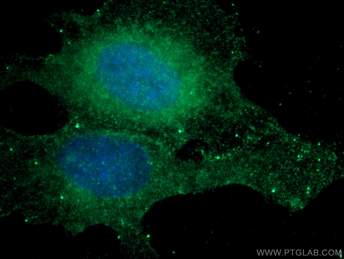 RAB5A Antibody 11947-1-AP | Proteintech