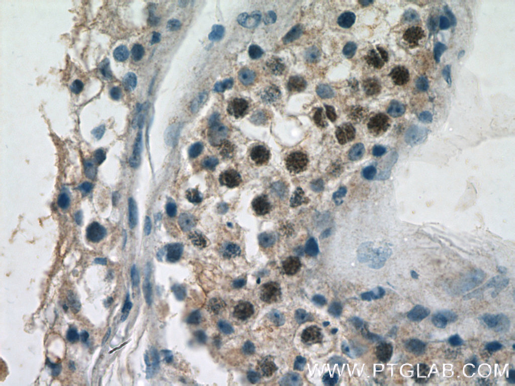 RAD51 Antibody 14961-1-AP | Proteintech