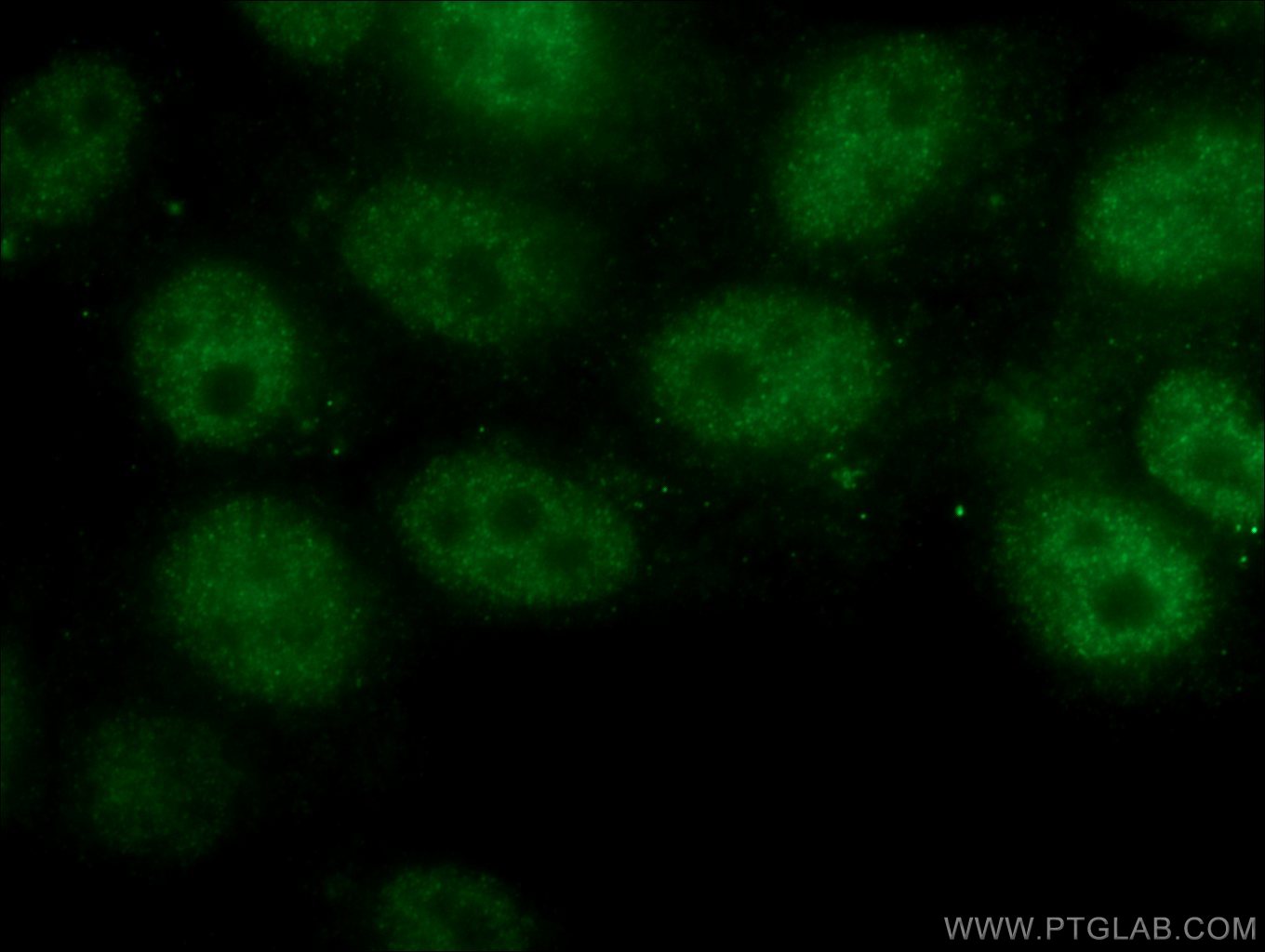 RB1 Antibody 25628-1-AP | Proteintech