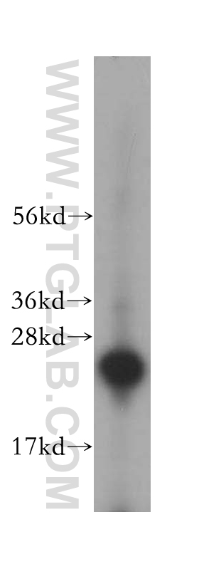 RBP4 Antibody 11774-1-AP | Proteintech