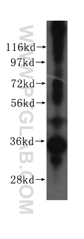 RPLP0 Antibody 11290-2-AP | Proteintech
