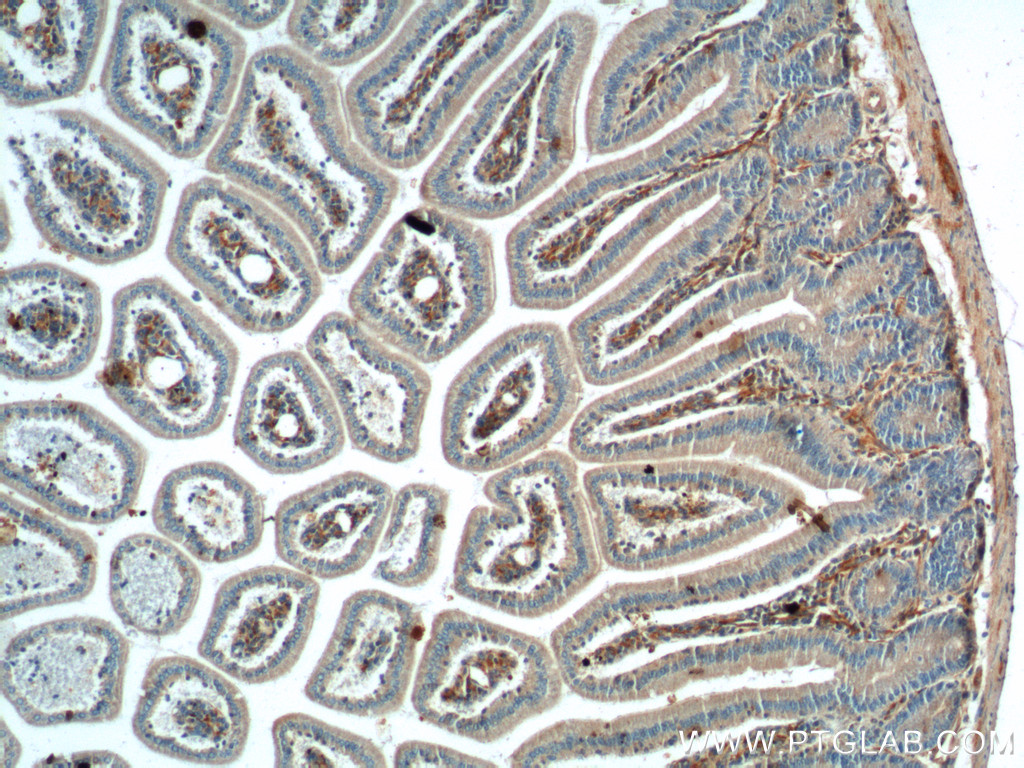 RSPO2 Antibody 17781-1-AP | Proteintech