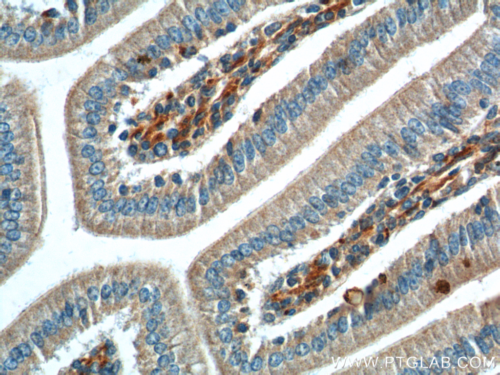 RSPO2 Antibody 17781-1-AP | Proteintech