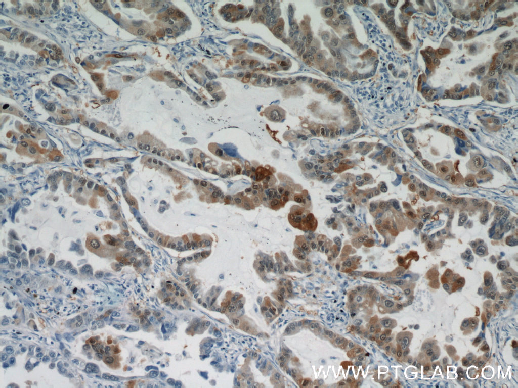 S100A6 Antibody 10245-1-AP | Proteintech