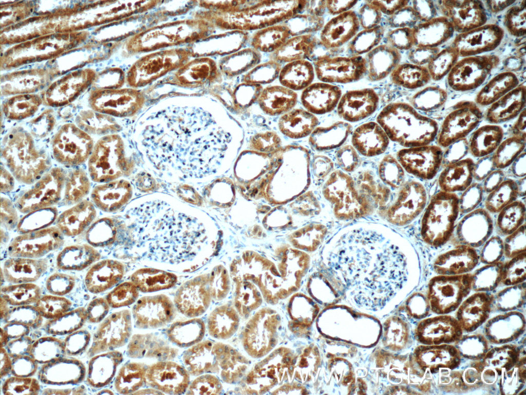 SCAP Antibody 12266-1-AP | Proteintech