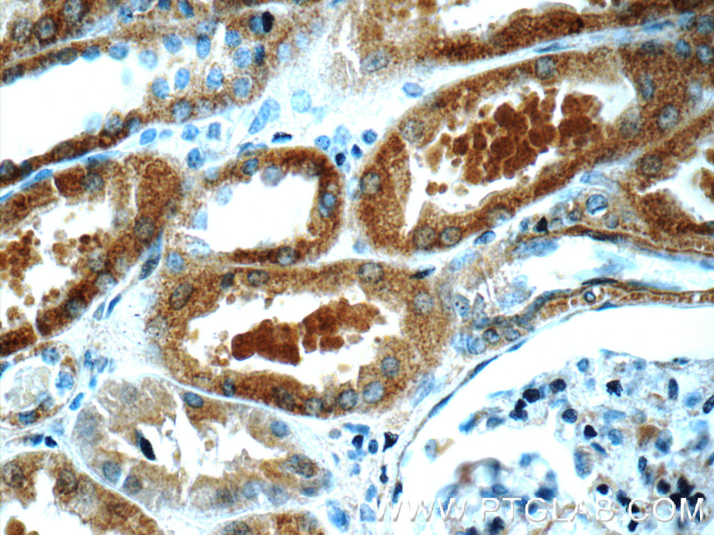 SCAP Antibody 12266-1-AP | Proteintech