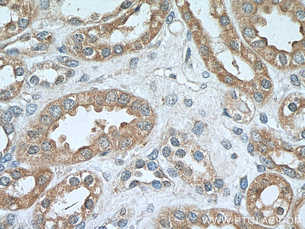 SDHB Antibody 10620-1-AP | Proteintech