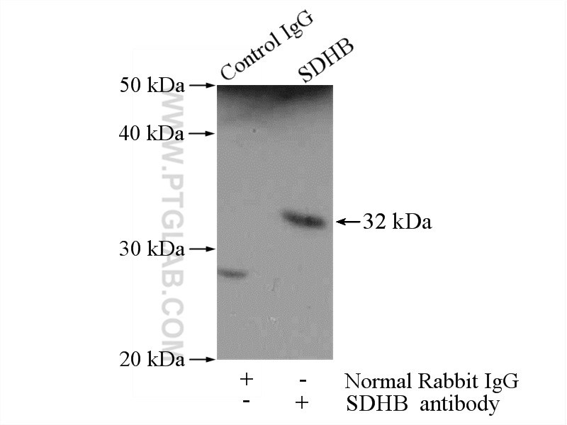 SDHB Antibody 10620-1-AP | Proteintech