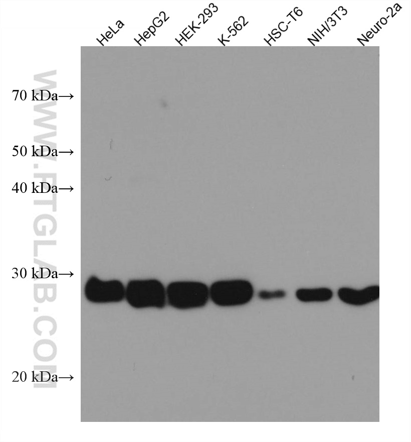 SDHB Antibody 67600-1-Ig | Proteintech