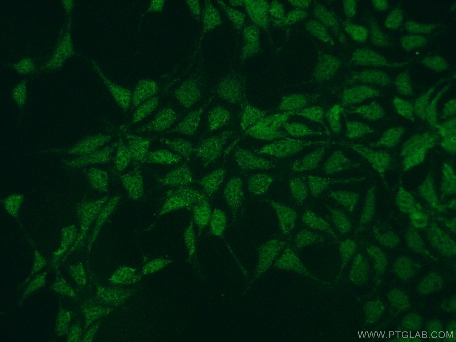 SF3B2 Antibody 10919-1-AP | Proteintech