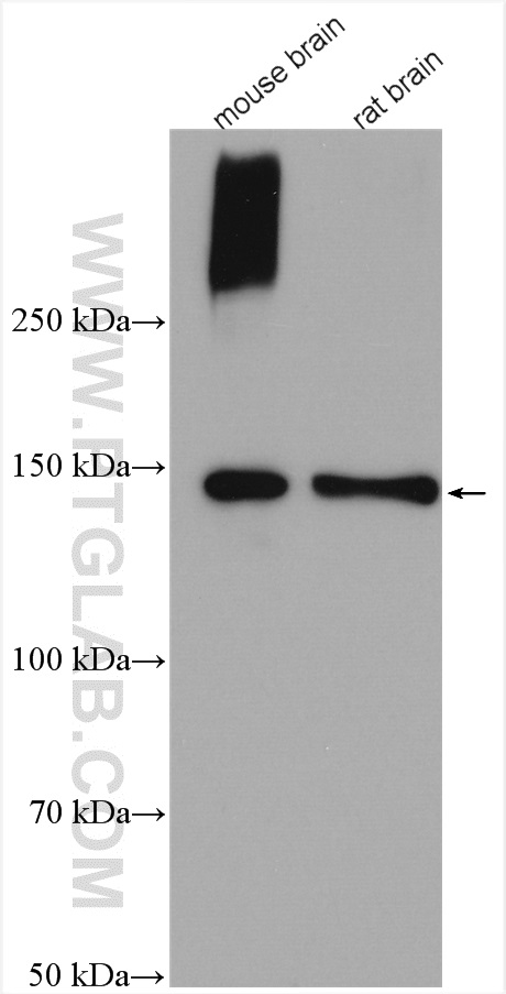 KCC2/SLC12A5-Specific Antibody 19565-1-AP | Proteintech