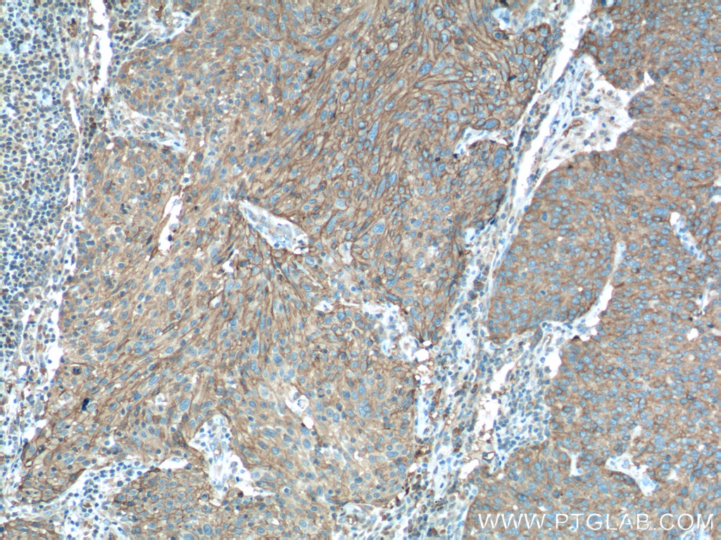 GLUT1 Antibody 21829-1-AP | Proteintech