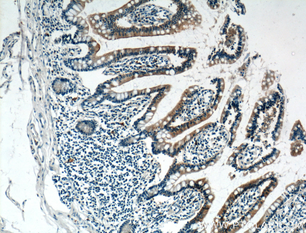 GLUT2 Antibody 20436-1-AP | Proteintech