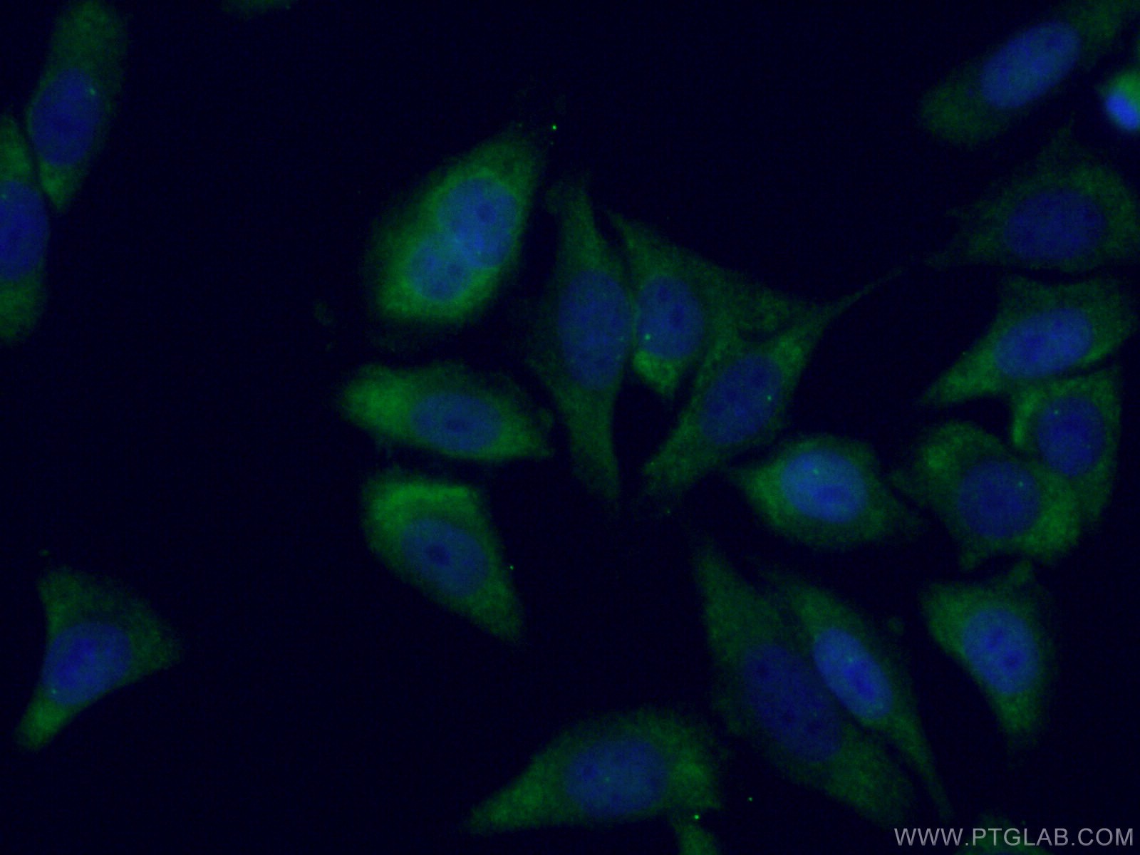 SMN Antibody 20451-1-AP | Proteintech SMN Antibody 20451-1-AP | Proteintech