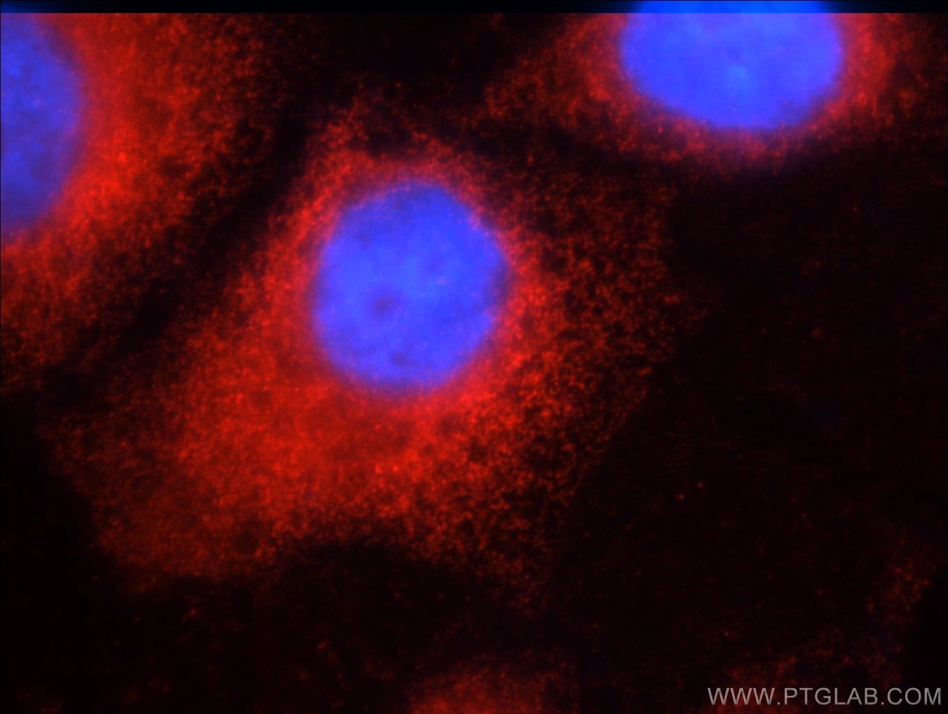 SMN (Human-Specific) Antibody 60154-1-Ig | Proteintech SMN (Human-Specific) Antibody 60154-1-Ig | Proteintech