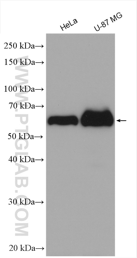 P62/SQSTM1 Antibody 18420-1-AP | Proteintech