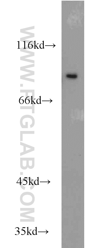 STAT1 Antibody 10144-2-AP | Proteintech