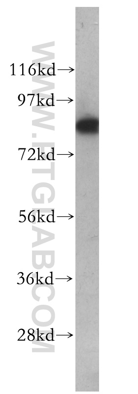 STAT1 Antibody 10144-2-AP | Proteintech