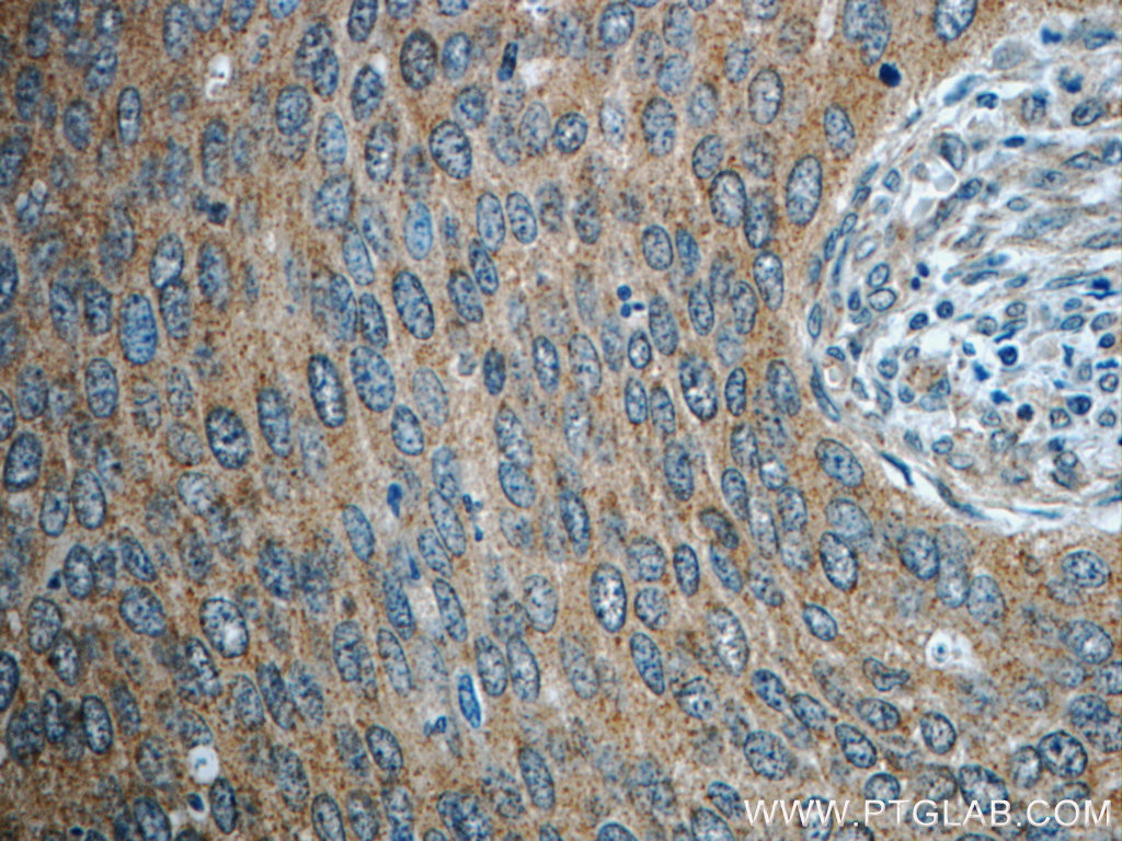 STAT3 Antibody 10253-2-AP | Proteintech