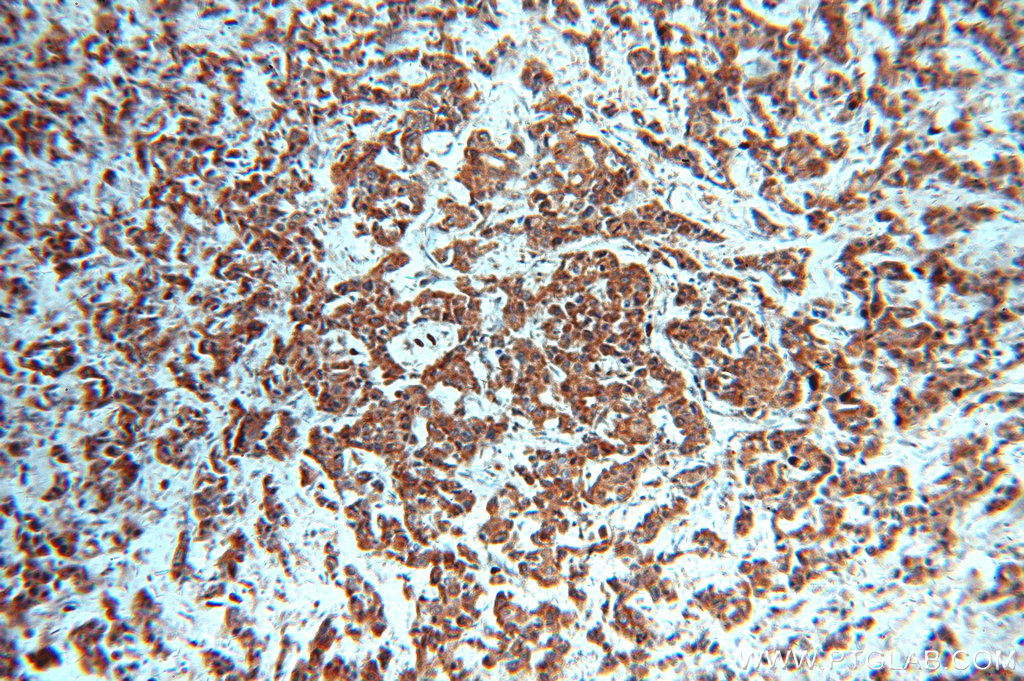 STAT3 Antibody 51076-2-AP | Proteintech